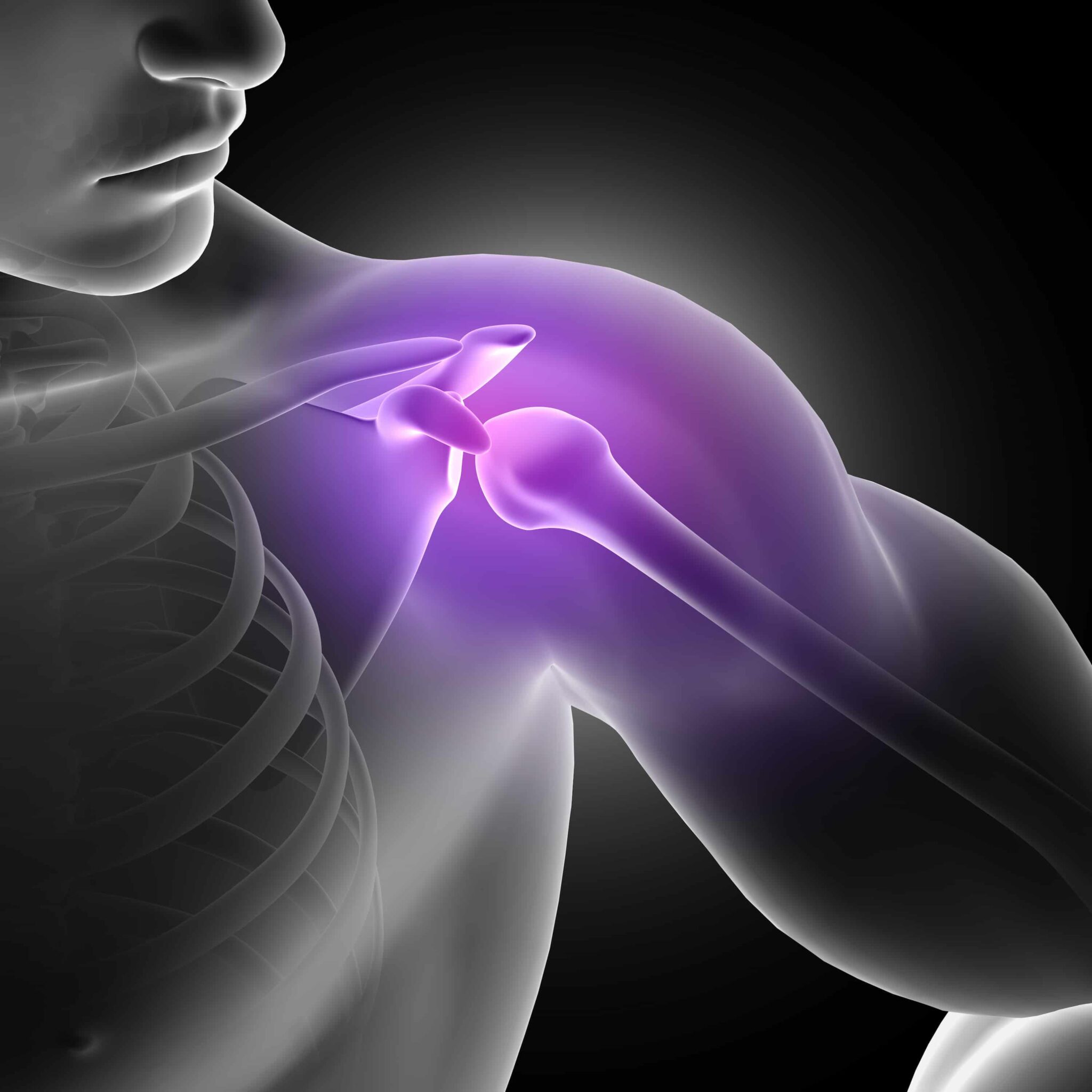 Dislocated Shoulder: Causes & Treatment